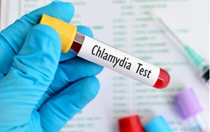 Understanding Chlamydia: Symptoms and Treatment - Exploring your mind